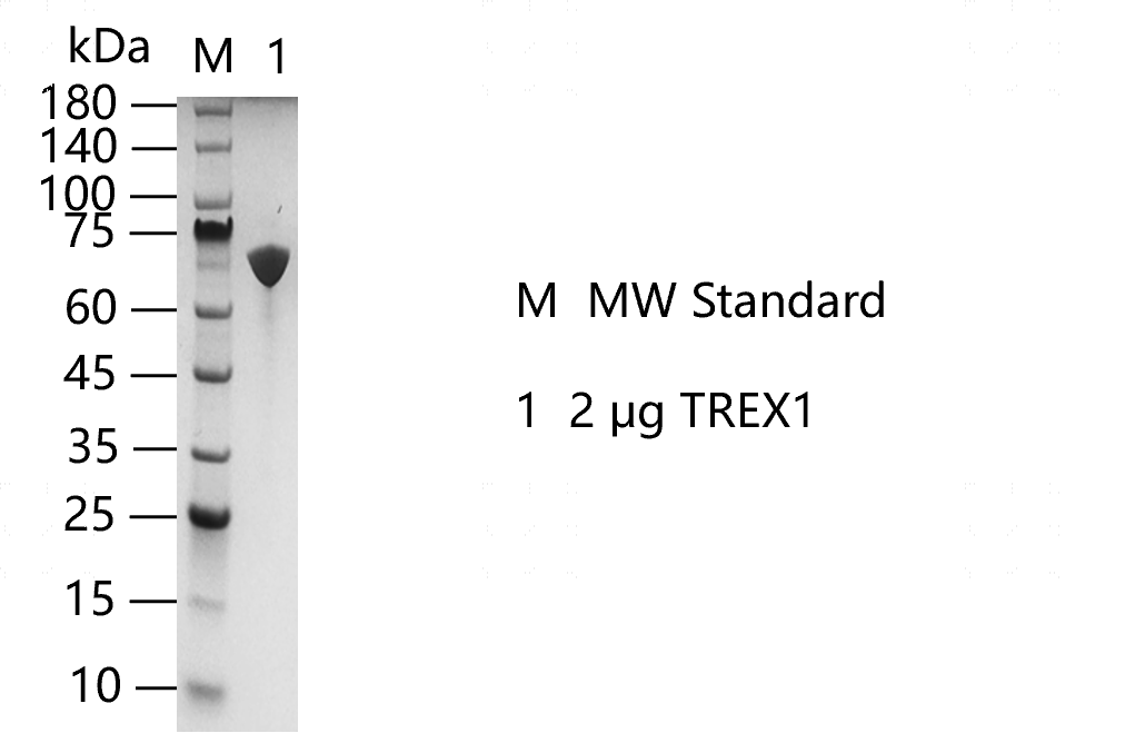 TREX1 - DNA损伤修复蛋白 - 爱思益普生物-蛋白平台